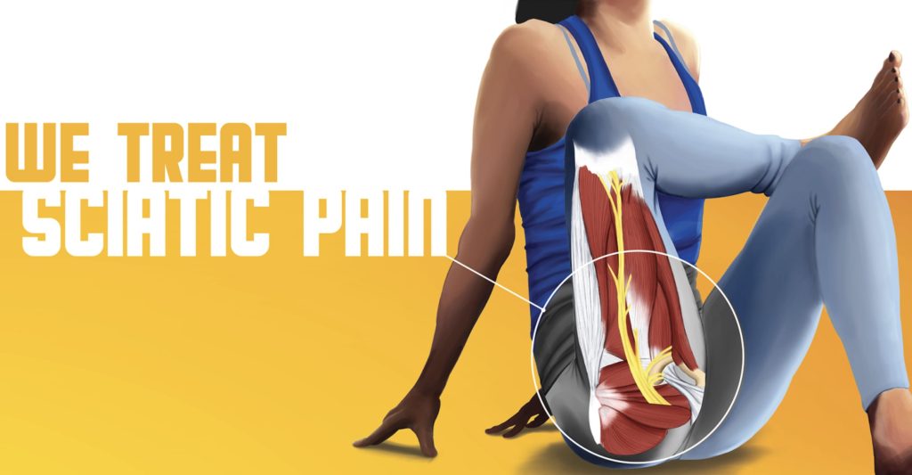 Sciatica Pain: Causes, Symptoms, and Top Relief Strategies